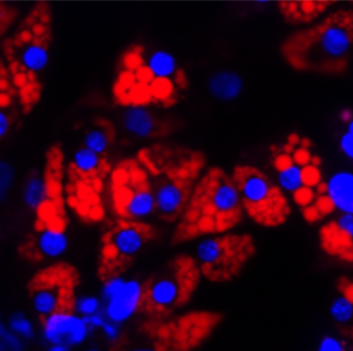 尼罗红脂肪荧光染色小课堂_北京普利莱基因技术有限公司